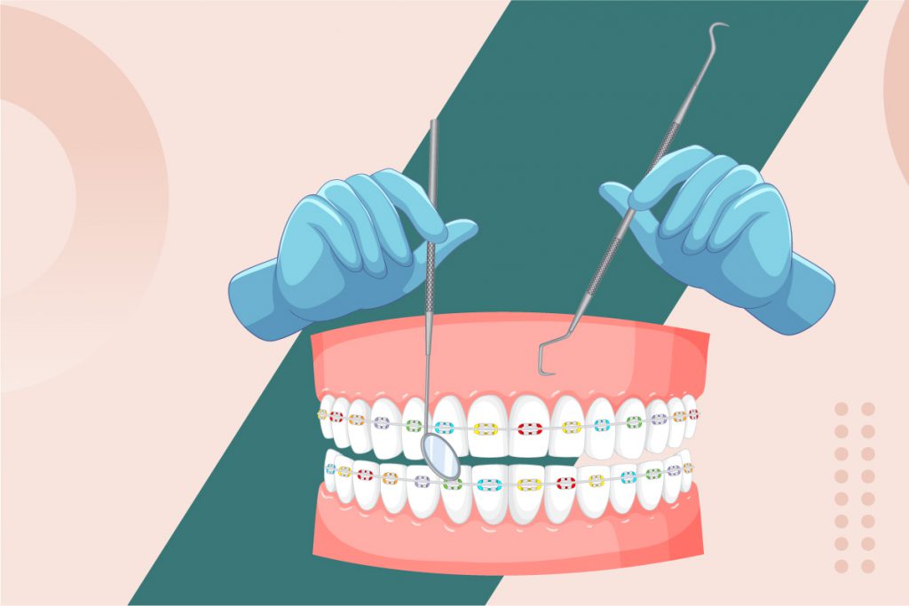 High-Quality Dental Hygiene Instruments By GerDentUSA Inc.